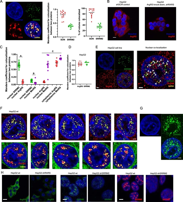 精氨酸-tRNA合成酶通过SRRM2将炎症代谢与RNA剪接和核运输联系起来—小柯机器人—科学网